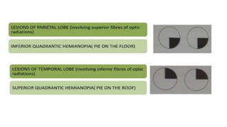 visual Pathway.pptx