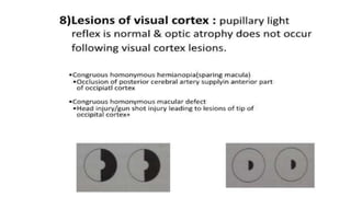 visual Pathway.pptx