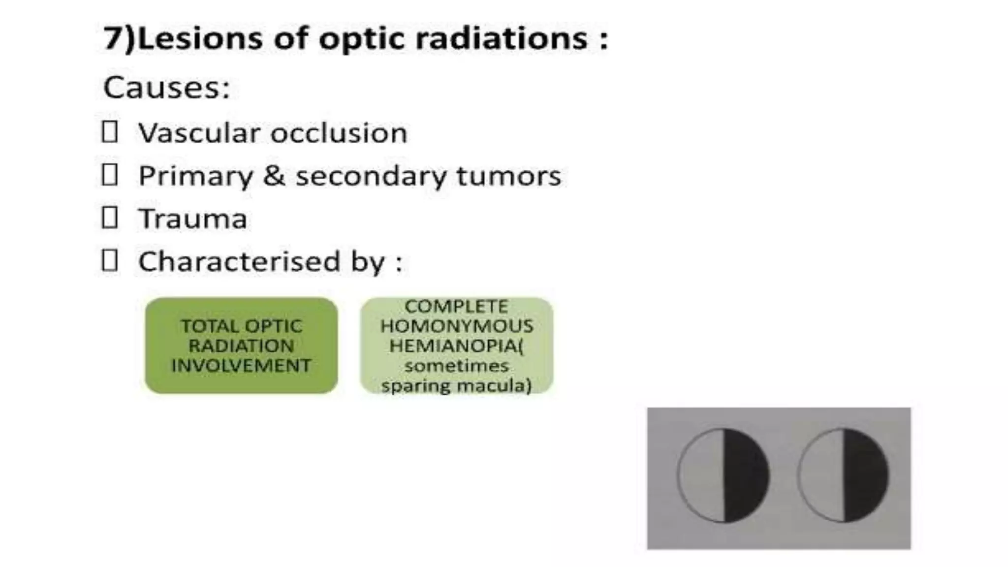visual Pathway.pptx