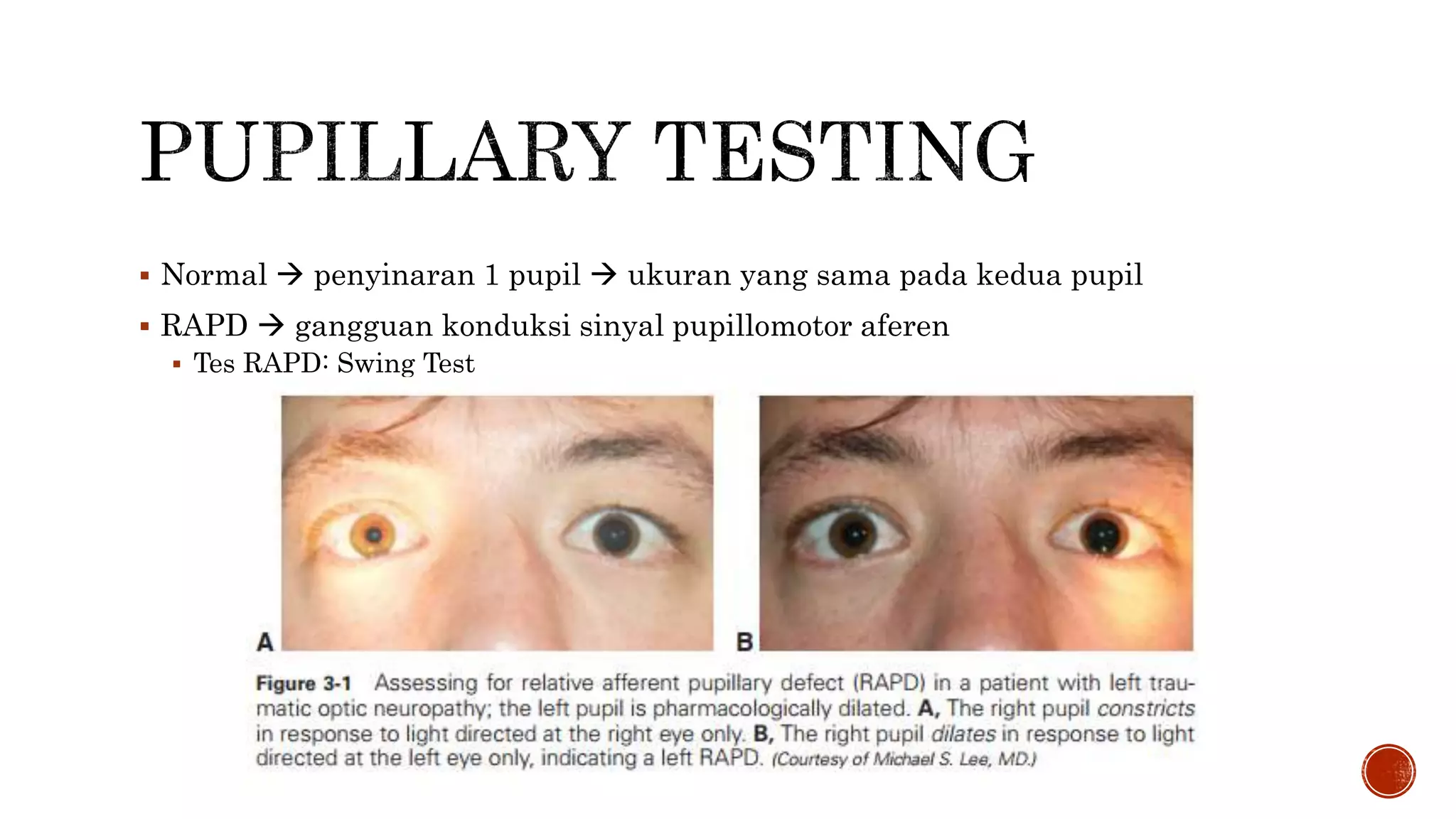 Visual pathway.pptx
