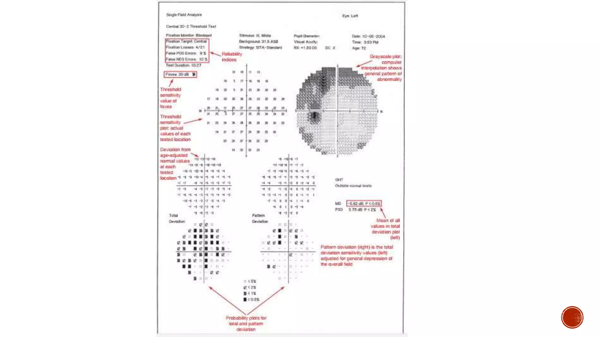 Visual pathway.pptx