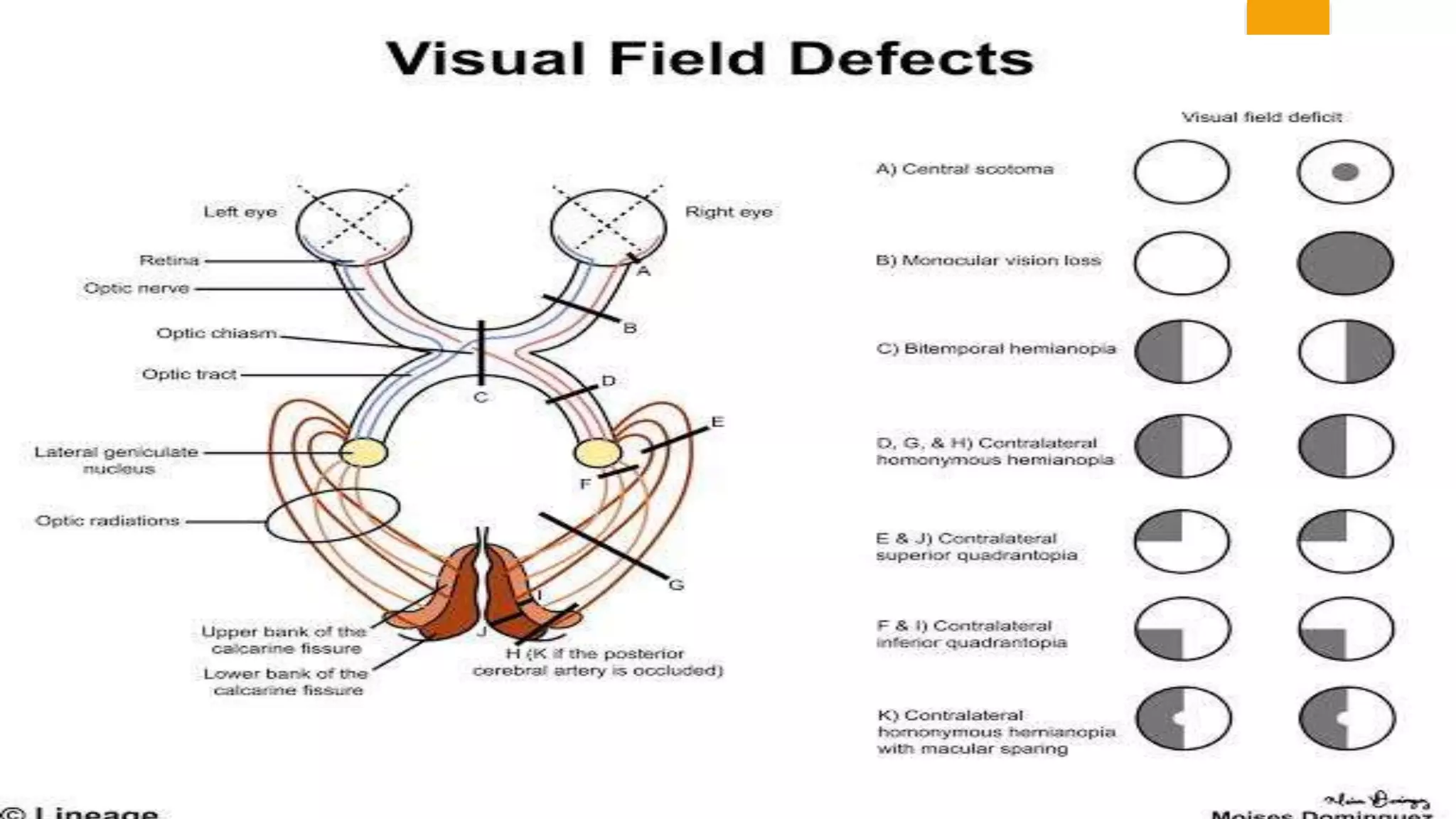visual pathway.pptx