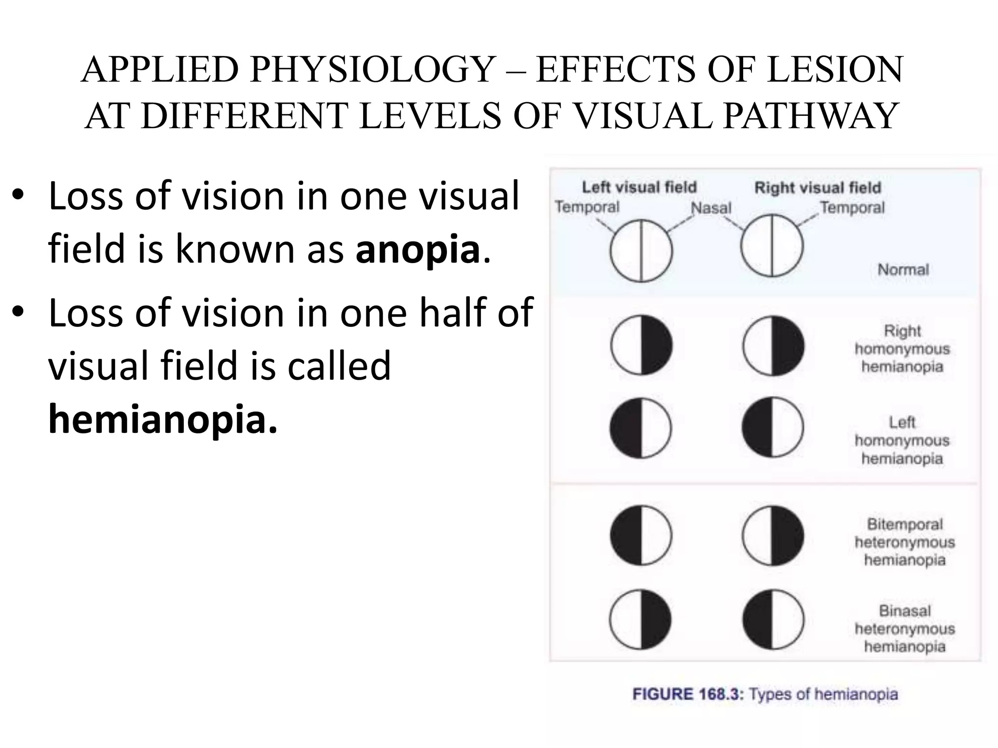 VISUAL PATHWAY.pptx