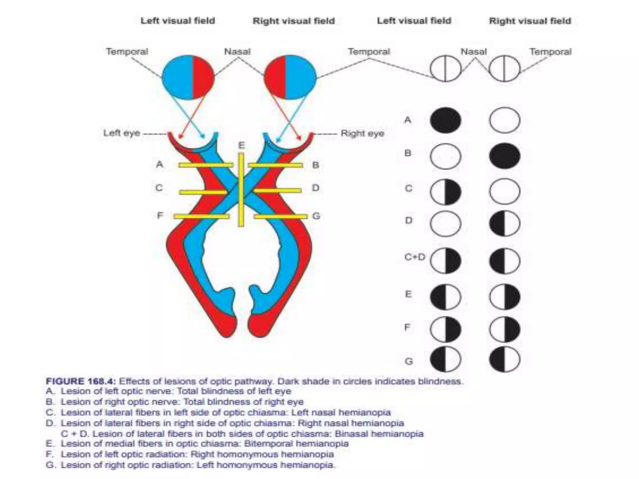 VISUAL PATHWAY.pptx