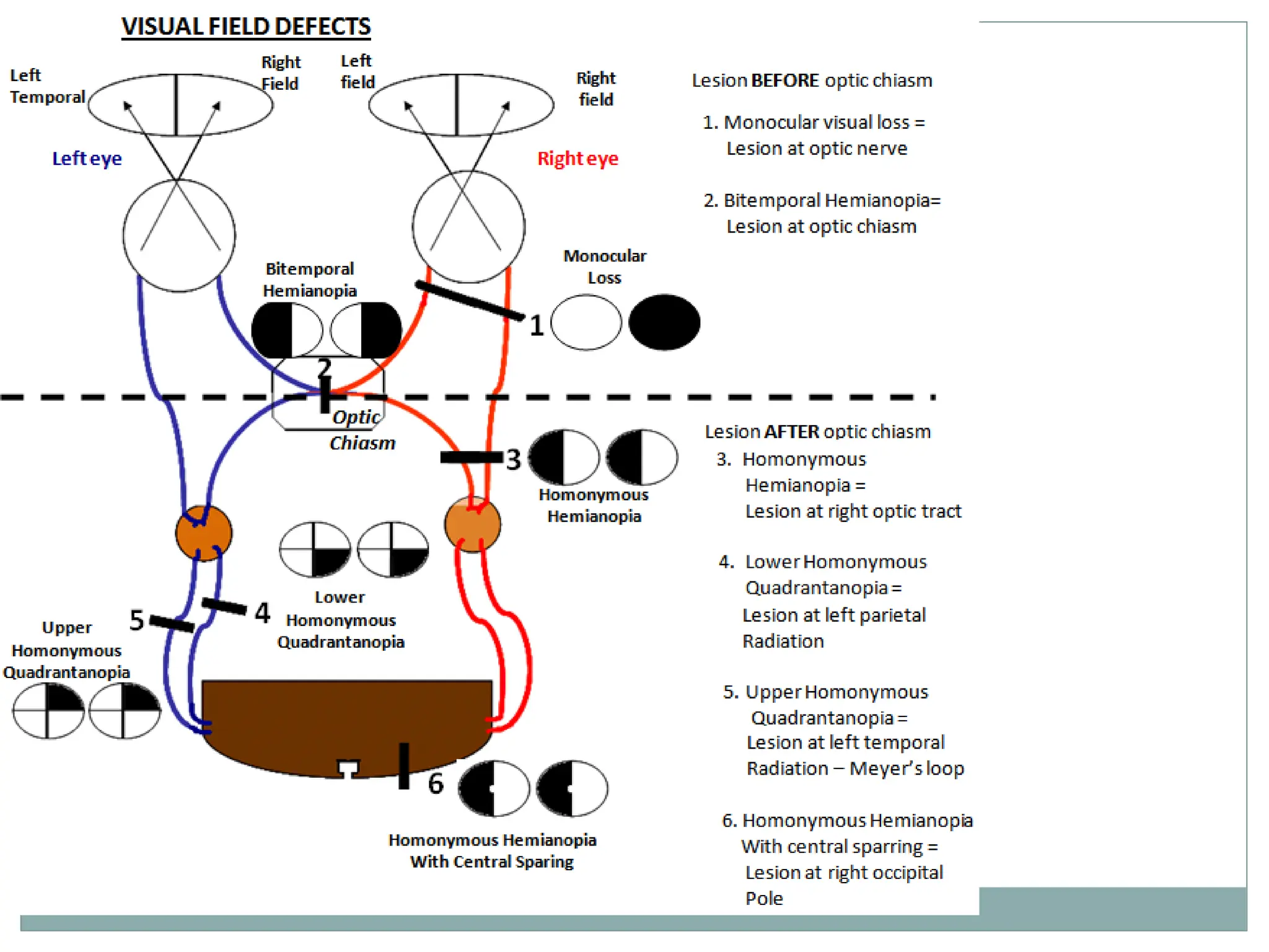 visual pathway in..... human beings.pptx