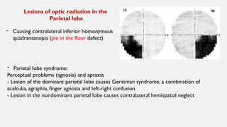 The Anatomy and the clinical side of the visual pathway | PPTX