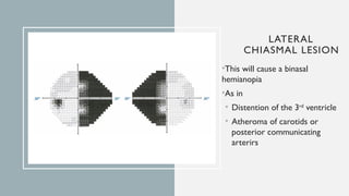 The Anatomy and the clinical side of the visual pathway | PPTX