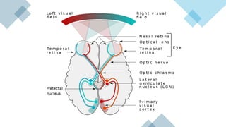 Visual pathway of eye with necessary lessions | PPTX