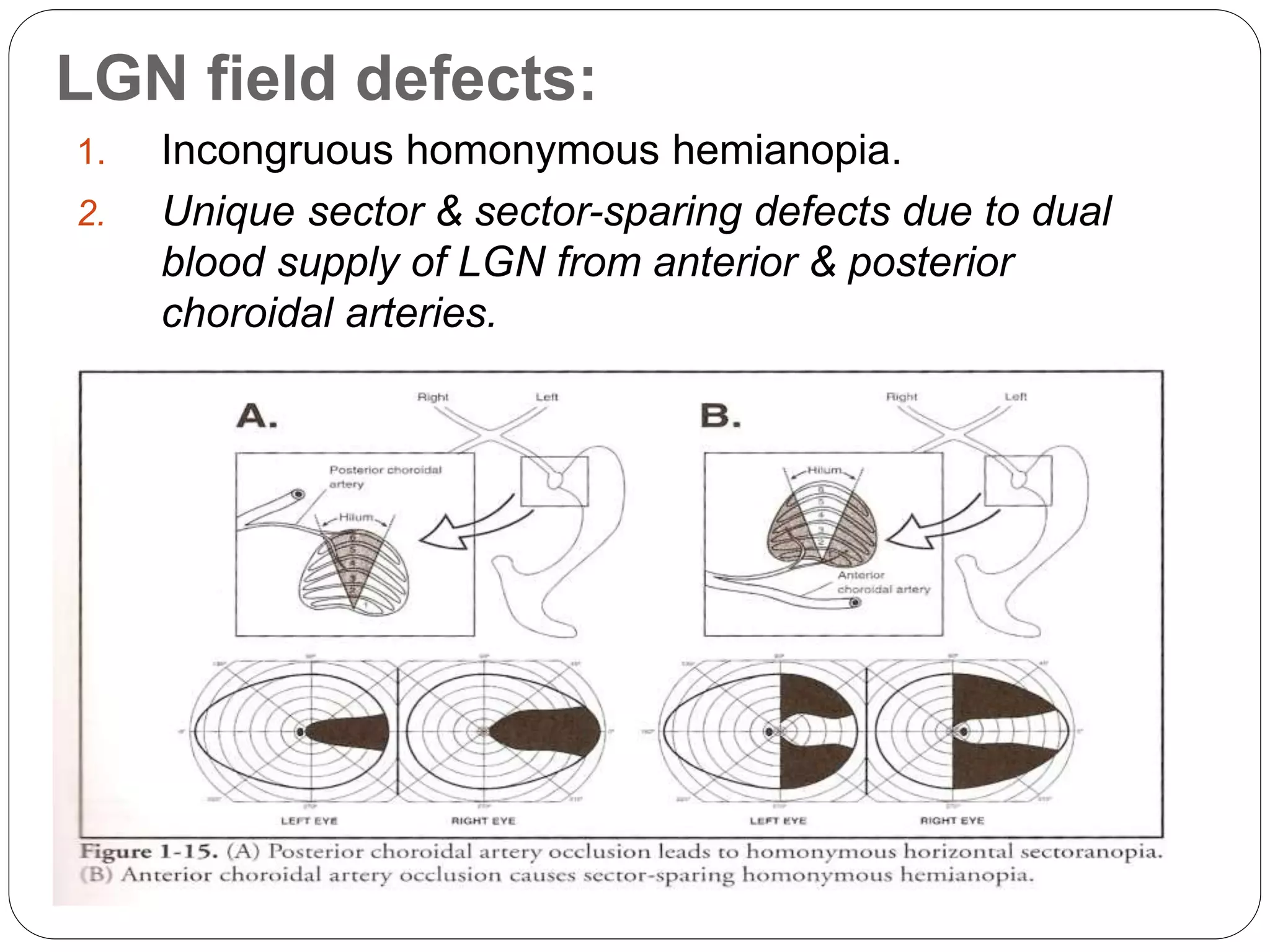 Visual pathway and its defects | PPTX
