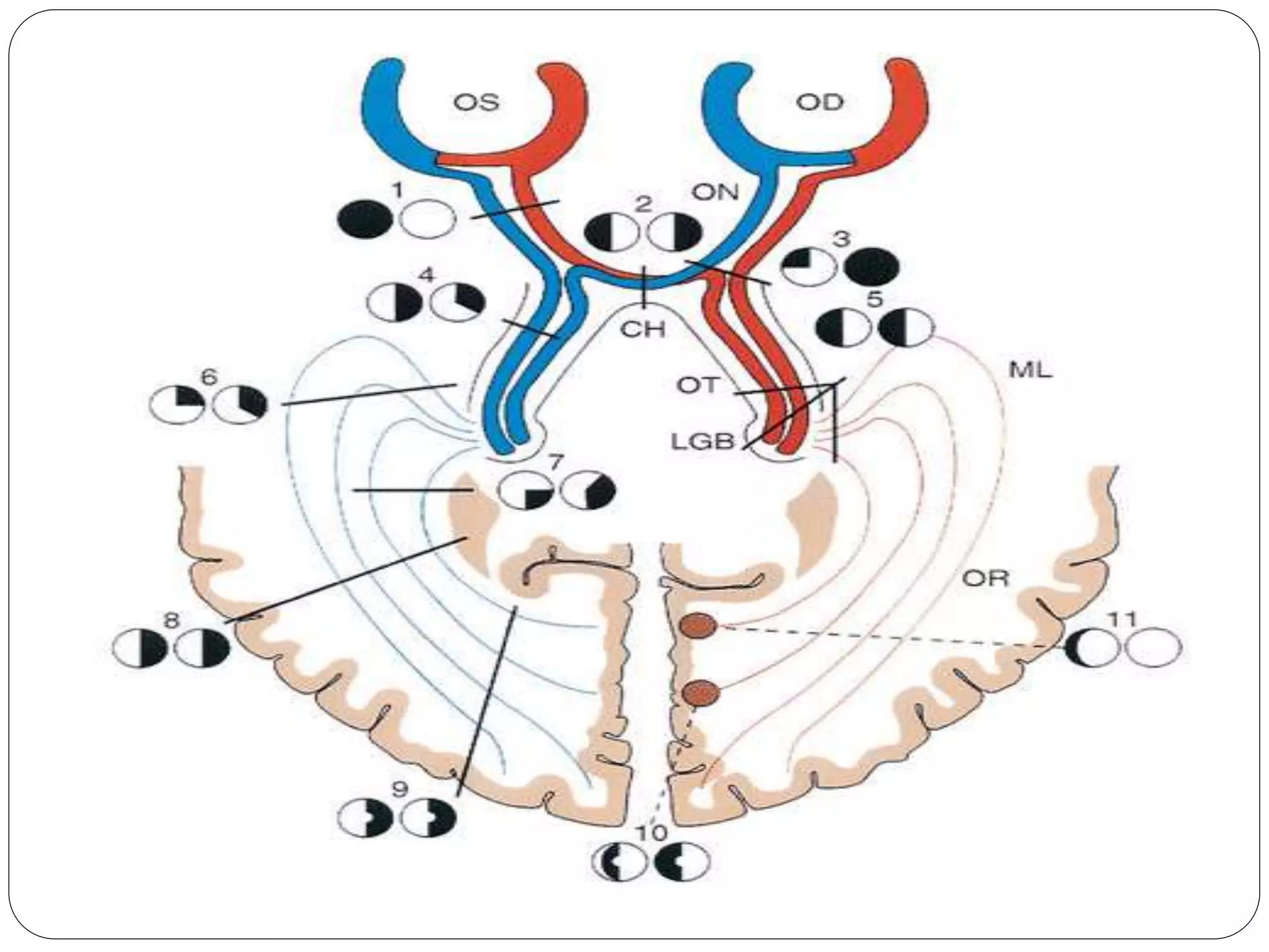 Visual pathway and its defects | PPTX