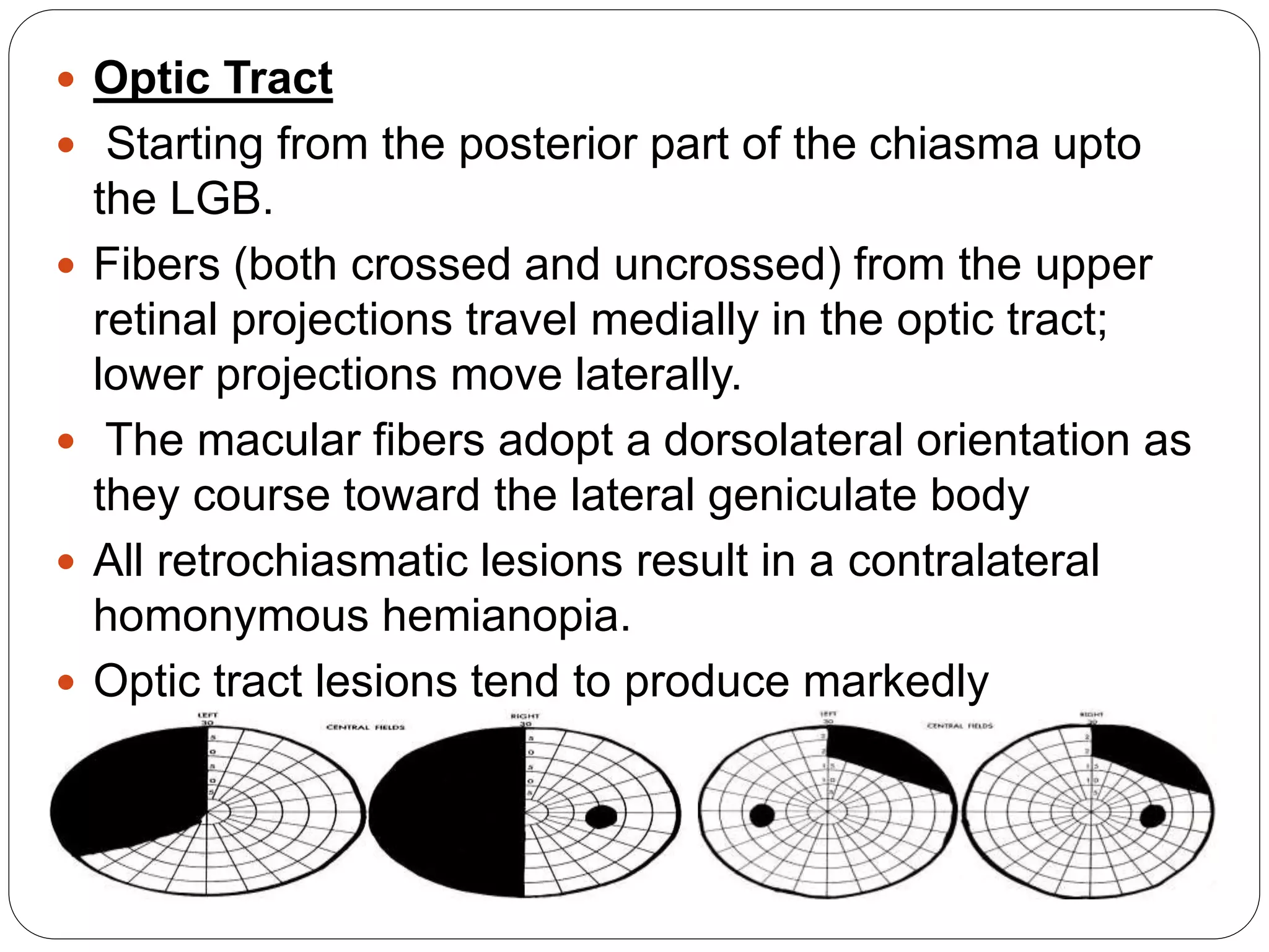 Visual pathway and its defects | PPTX