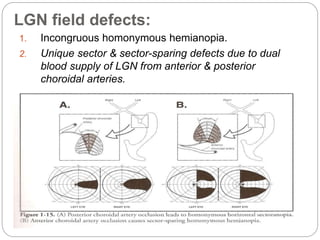 Visual pathway and its defects | PPTX
