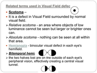 Visual pathway and its defects | PPTX