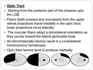 Visual pathway and its defects | PPTX