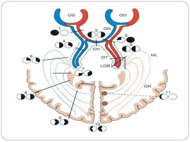 Visual pathway and its defects | PPT