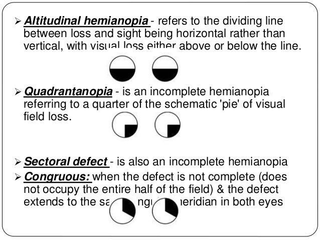 Visual pathway and its defects