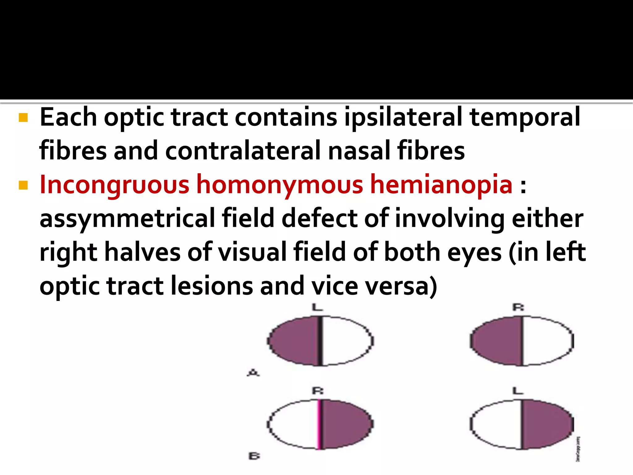 Visual pathway and its defects | PPTX