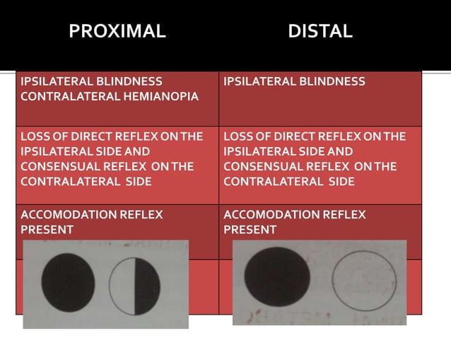 Visual pathway and its defects | PPTX