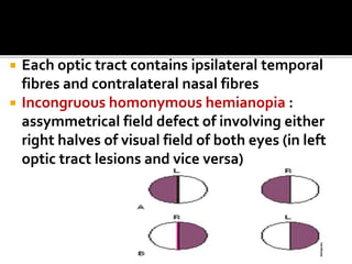 Visual pathway and its defects | PPTX