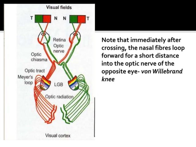 Visual pathway and its defects