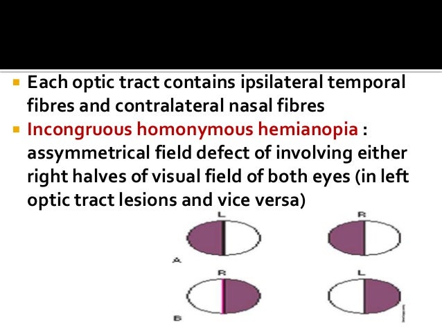 Visual pathway and its defects