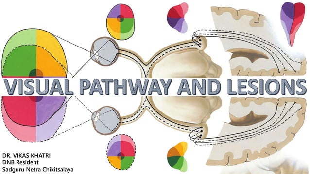 Visual pathway and lesion | PPTX