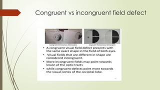 Visual pathway and lesionsCEREBELLOPONTINE ANGLE AND THEIR CONTENTS.pptx