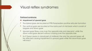 Visual pathway and lesionsCEREBELLOPONTINE ANGLE AND THEIR CONTENTS.pptx