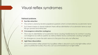 Visual pathway and lesionsCEREBELLOPONTINE ANGLE AND THEIR ...