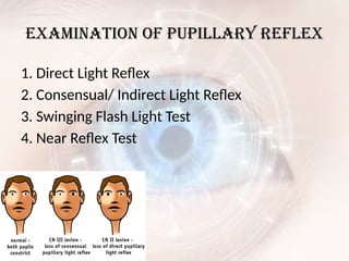 visual pathway diseases and clinical significance pptx | PPTX