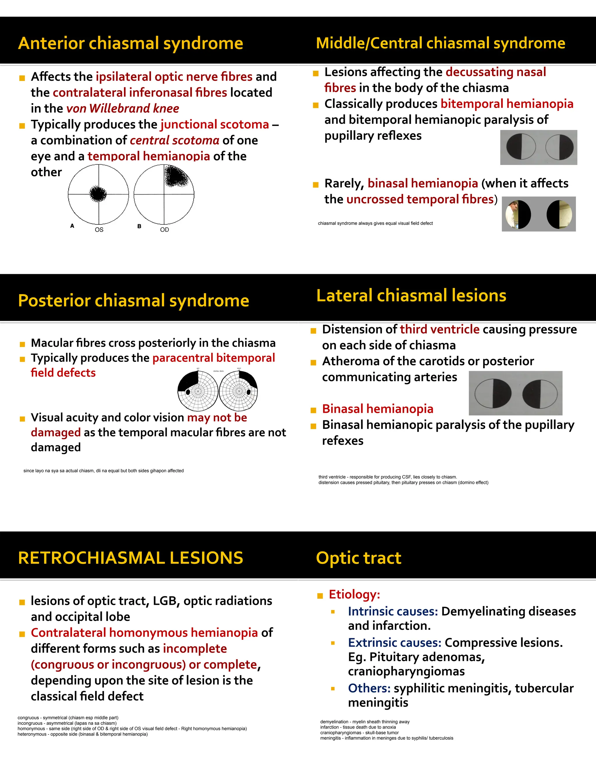 Visual Pathway Disorders.pptx.pdfcvnfbffjjf | PDF