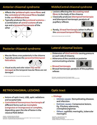 Visual Pathway Disorders.pptx.pdfcvnfbffjjf | PDF