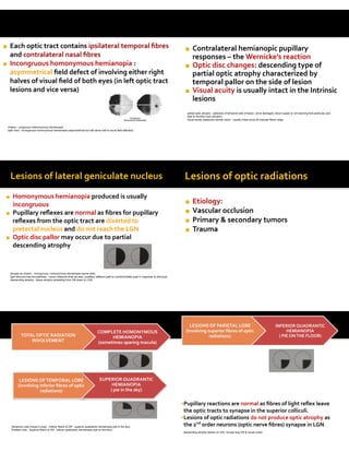Visual Pathway Disorders.pptx.pdfcvnfbffjjf | PDF