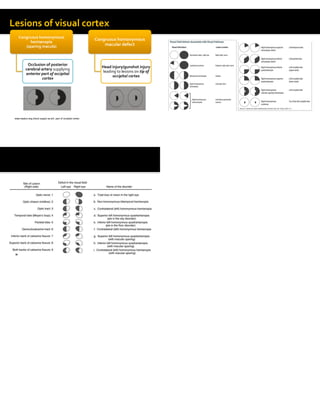 Visual Pathway Disorders.pptx.pdfcvnfbffjjf | PDF