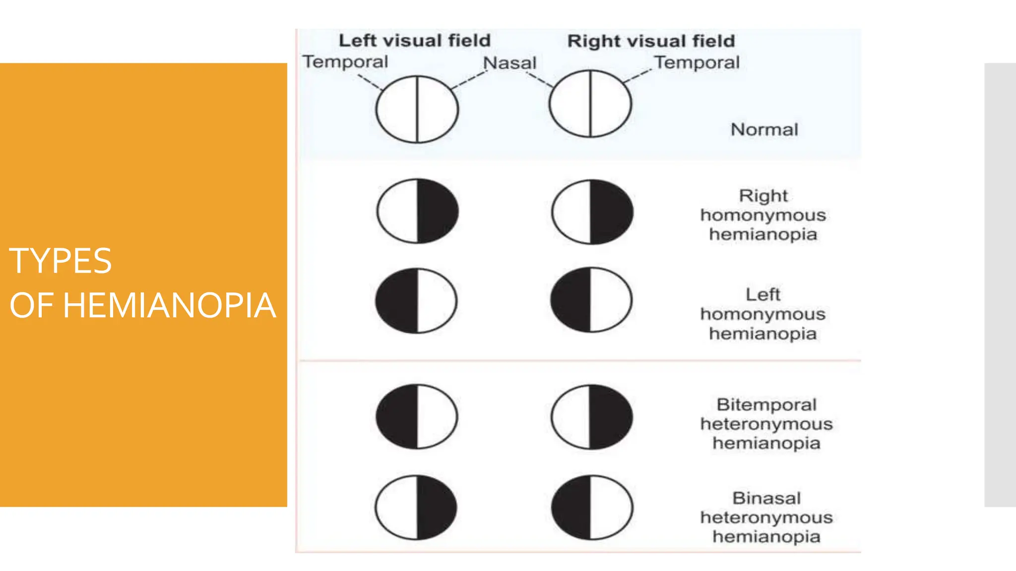 ANATOMY AND PHYSIOLOGY OF VISUAL PATHWAY | PPTX
