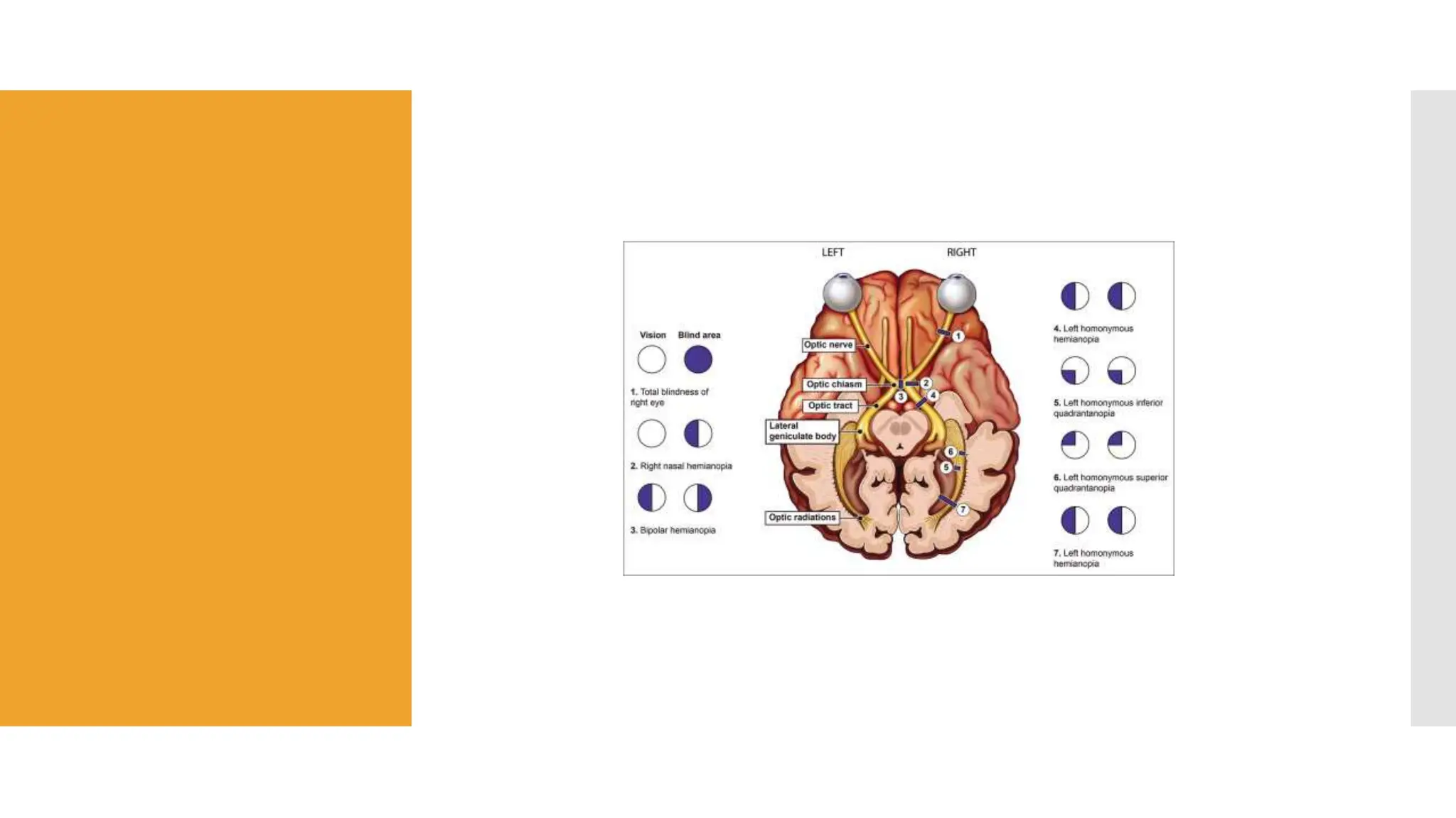 ANATOMY AND PHYSIOLOGY OF VISUAL PATHWAY | PPTX