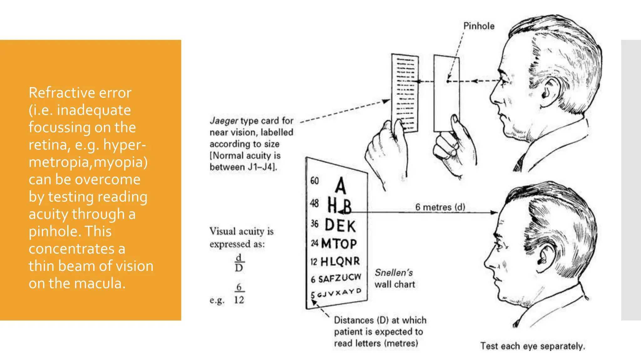 ANATOMY AND PHYSIOLOGY OF VISUAL PATHWAY | PPTX