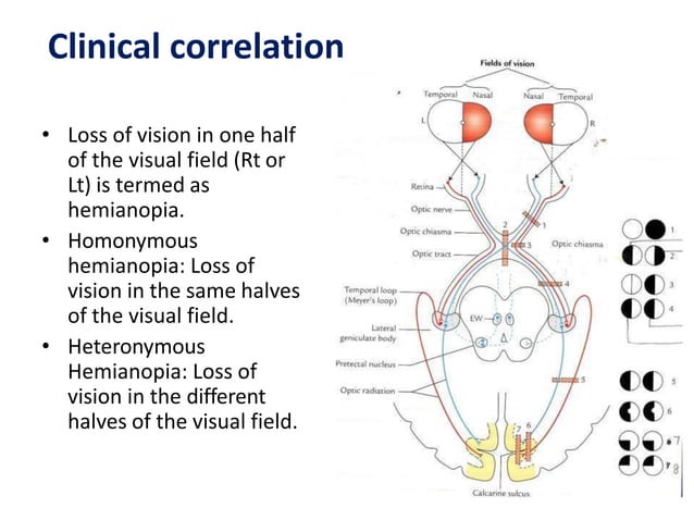 visual pathway & its lesions.pptx | Eye and Vision Conditions ...