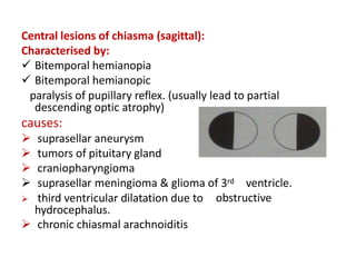 visual pathway & its lesions.pptx