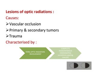 visual pathway & its lesions.pptx