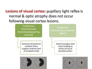visual pathway & its lesions.pptx