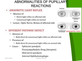 Visual pathway kHem | PPTX