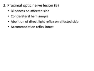 Visual pathway & optic nerve tumours | PPT