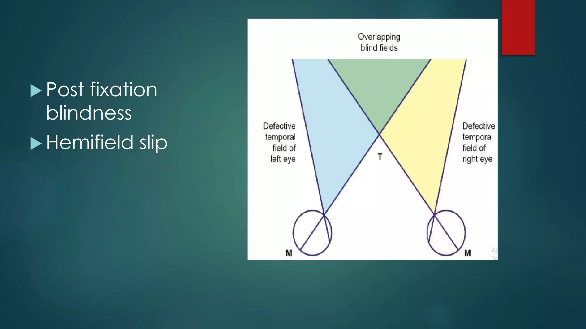 Visual pathways and optic nerve. | PPTX