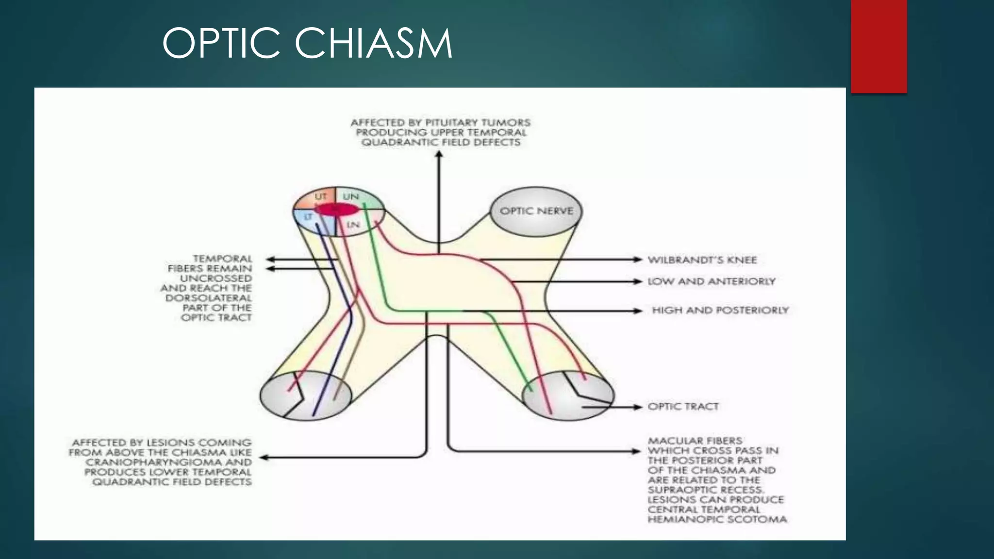 Visual pathways and optic nerve. | PPTX