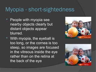 Visual Problems - symptoms and signs of poor vision.pptx