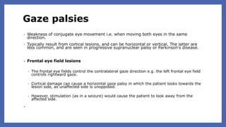 Visual problems, nystagmus, and vertigo | PPT