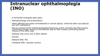 Visual problems, nystagmus, and vertigo | PPT