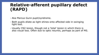 Visual problems, nystagmus, and vertigo | PPT