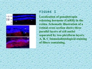 Visual processing in_vertebrate_retina | PPT